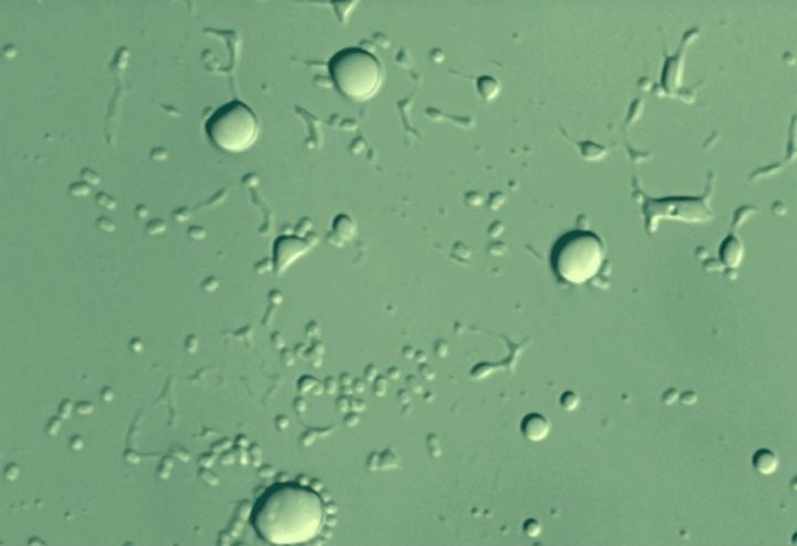 Completato il genoma del 'batterio mangiapetrolio'